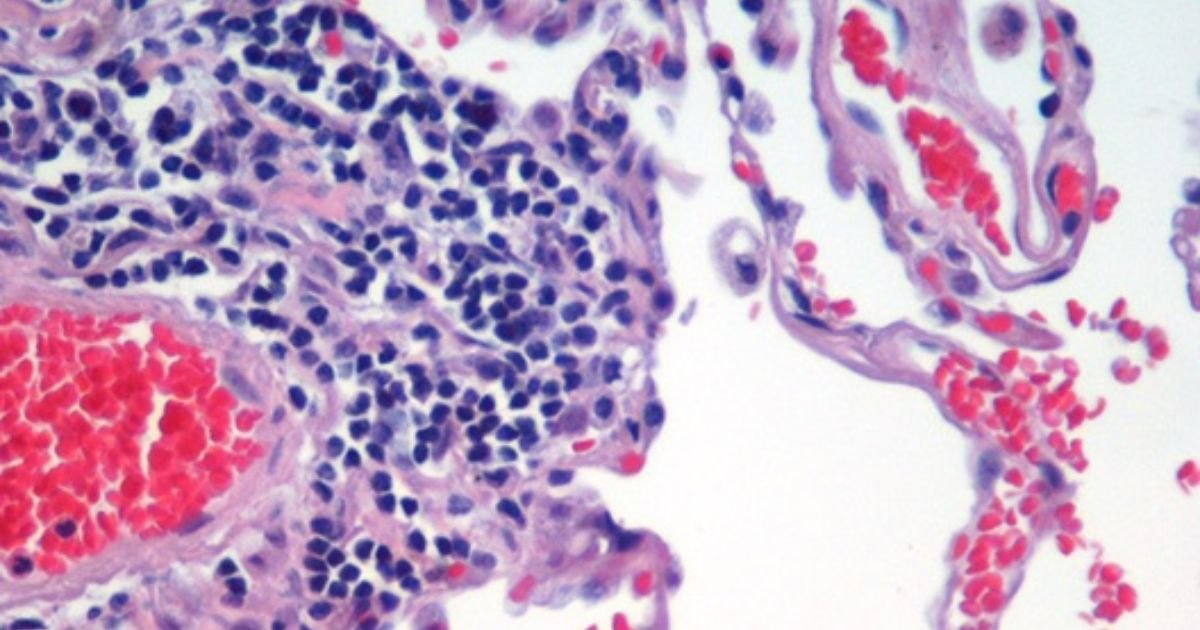 Staining In Clinical Microscopy: Revealing The Invisible | Sean Schepers