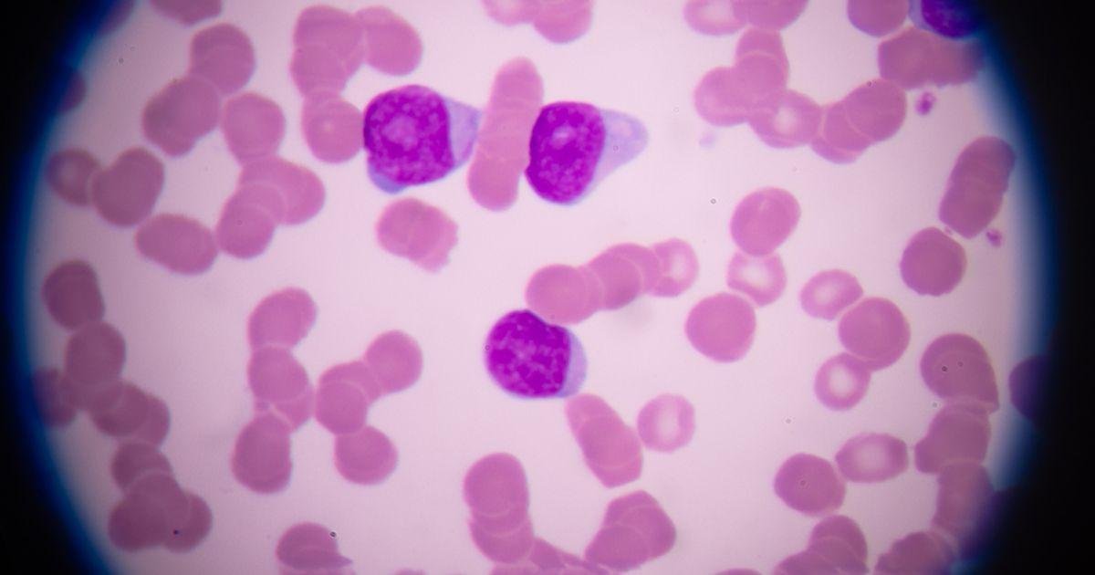 Basophils And Mast Cells | Sean Schepers