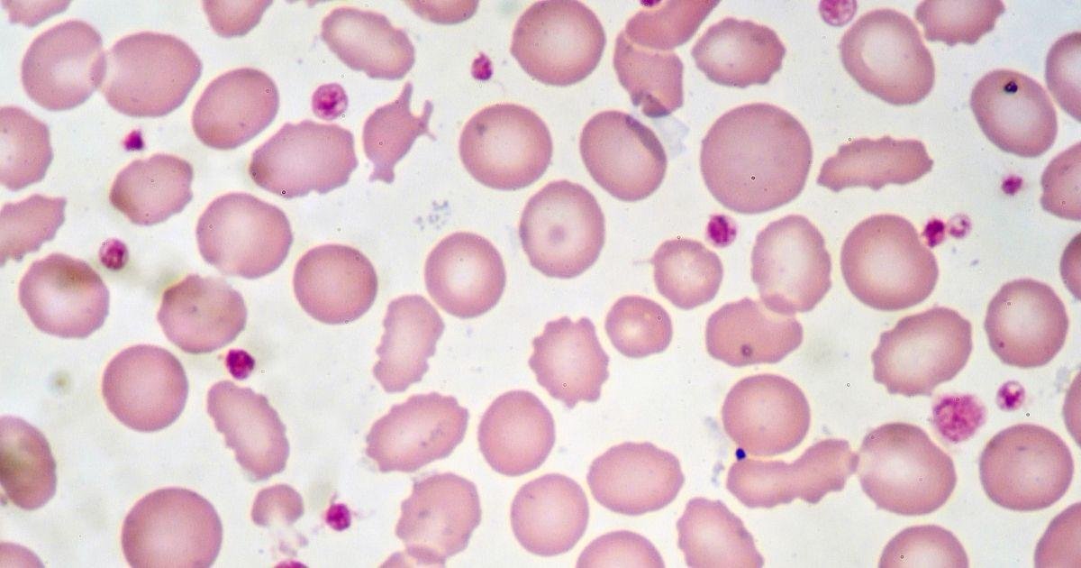 Blood Components And Their Functions | Sean Schepers