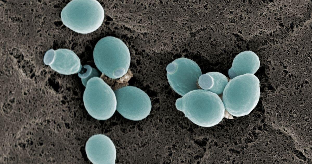 Fungal Classification And Taxonomy | Sean Schepers