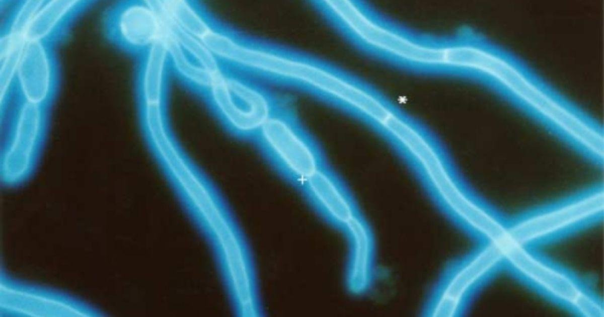 Fungal Staining (KOH, Calcofluor White) And Interpretation | Sean Schepers