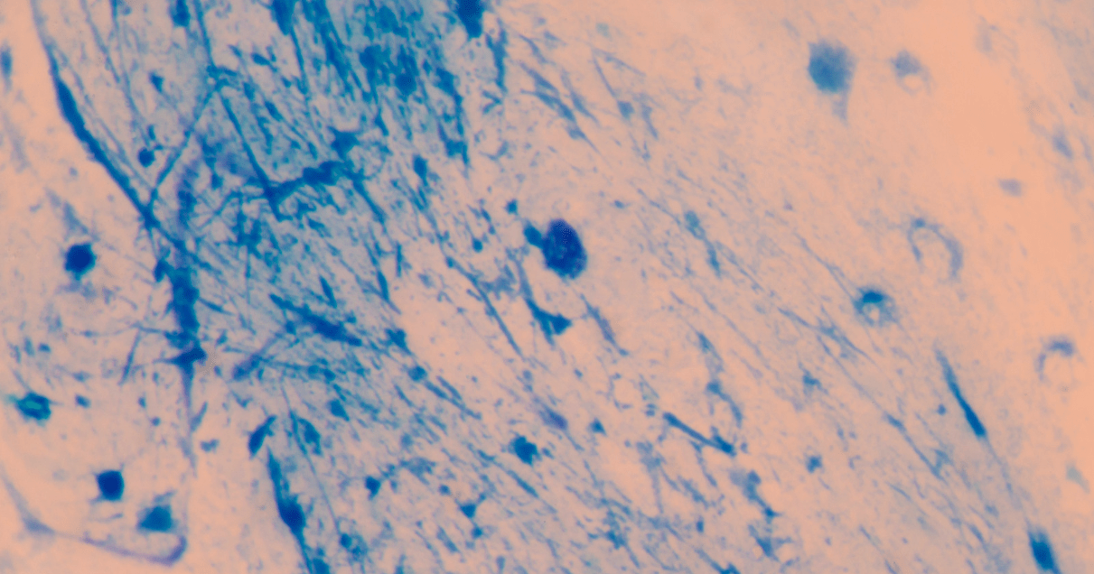 Staining In Clinical Microscopy: Revealing The Invisible | Sean Schepers